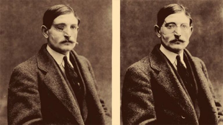 100 years ago today… World War I eyewear and the Tin Noses Shop - The ...